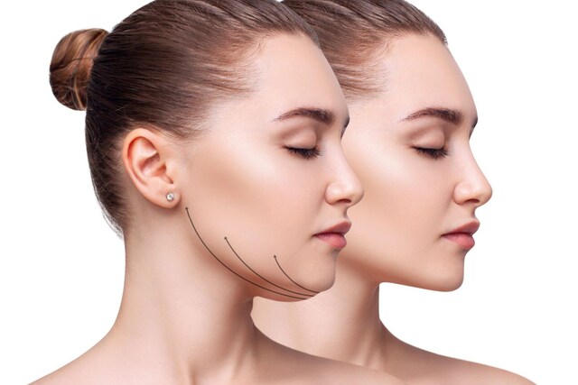 Double Chin: Know The Causes And How Can It Be Treated? - News18