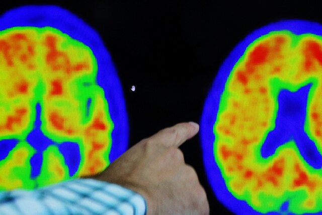 New Study Identifies Gene 'fingerprint' For Brain Ageing, Sheds Light ... New Study Identifies Gene 'fingerprint' For Brain Ageing, Sheds Light ...