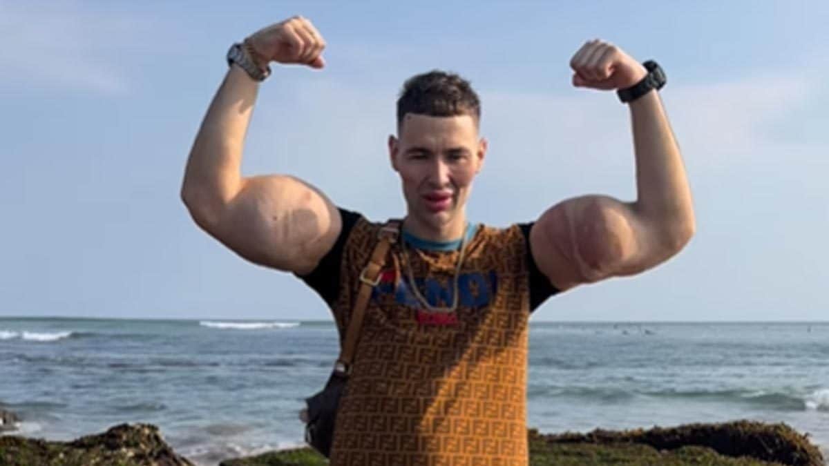 Viral Video Of Russian Man Flexing His Biceps Stuns Internet | Viral ...