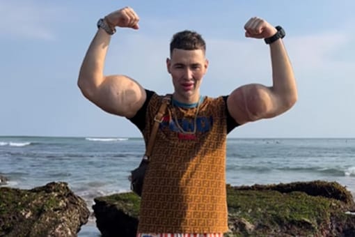 Viral Video Of Russian Man Flexing His Biceps Stuns Internet - News18