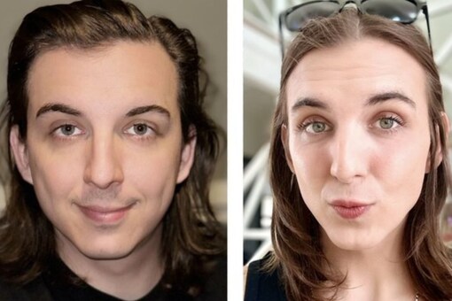 MrBeast's BFF Chris Tyson Shares Transformation Pics After 6 Months of HRT, Gets Ridiculed Again ...