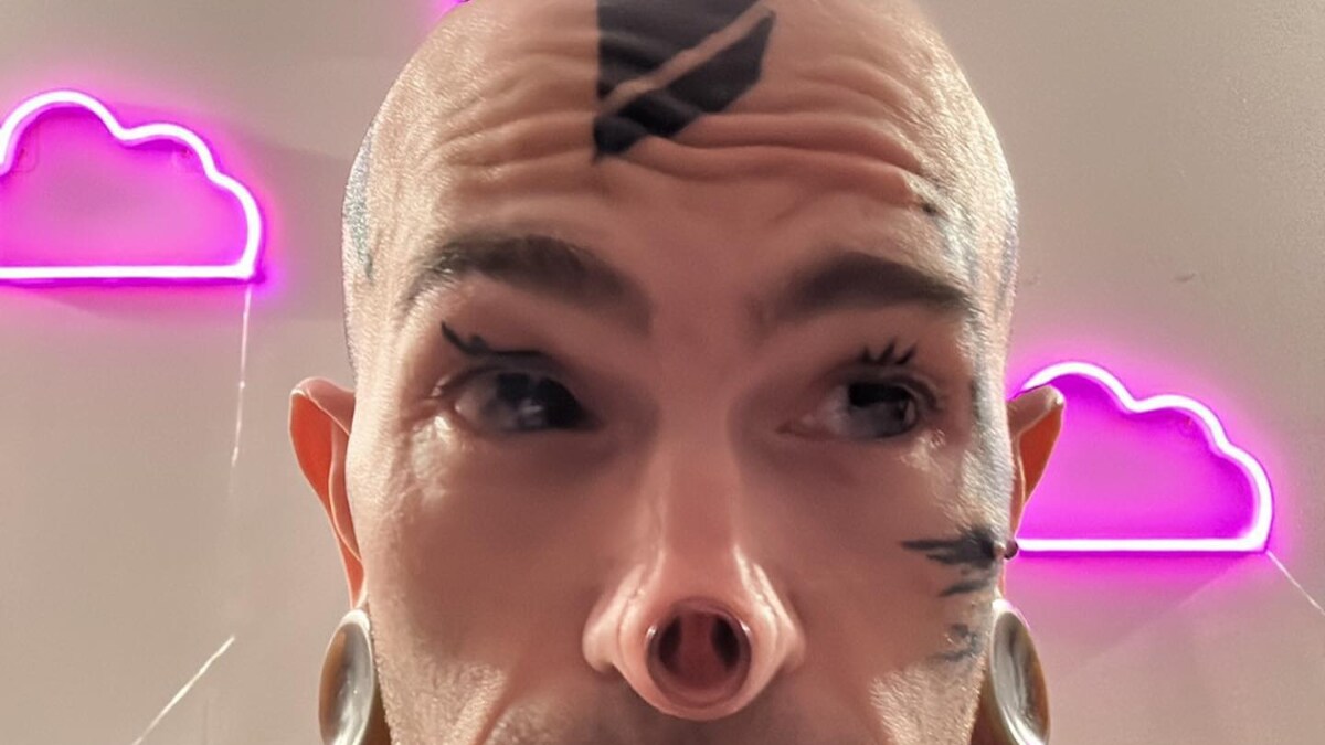 Man Who Removed Part Of Nose For 'Body Art' Says He's Being Harassed On ...