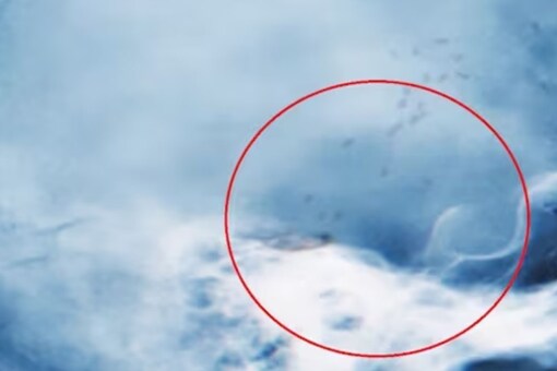 Watch: Insect Found Inside Man's Head in Bizarre X-ray Report - News18