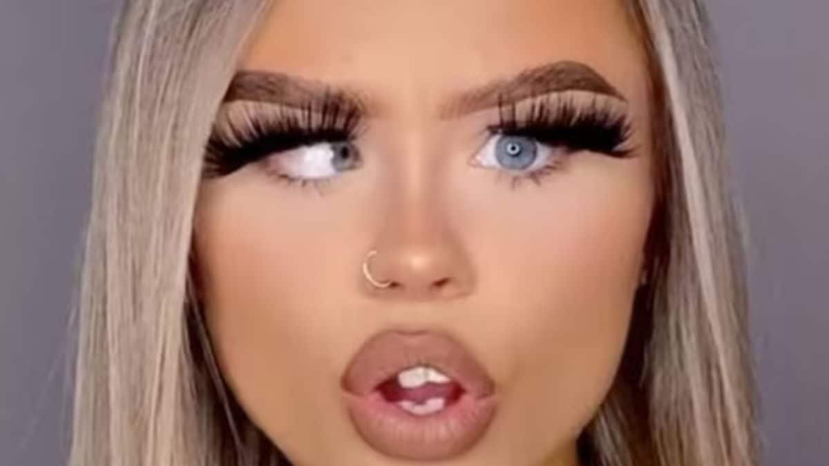 UK Model With Lazy Eye, Who Claims To Have Earned Rs 3 Crore, Now Opts ...