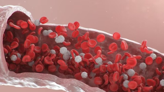 Suffering From Low Haemoglobin Levels? Add These Foods To Your Diet ...