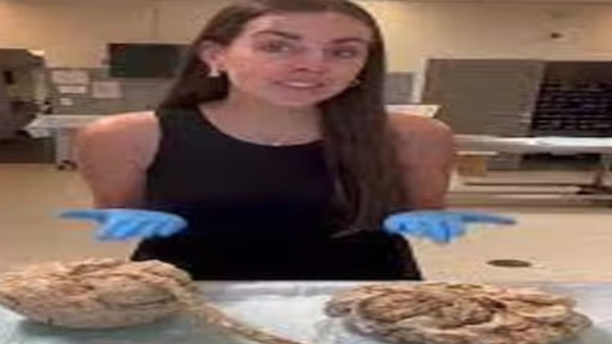Watch: Woman Holding Human Brain In Her Hands Shows How It Works ...