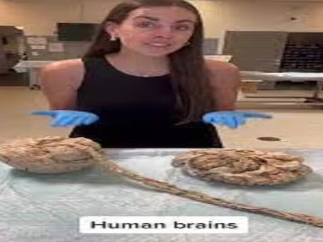Watch: Woman Holding Human Brain In Her Hands Shows How It Works - News18
