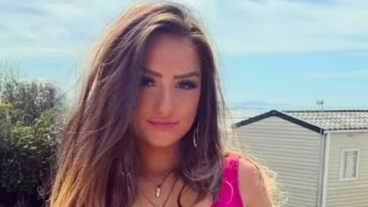 UK Model, Once Bullied For ‘Being Ugly’, Earns Rs 30 Lakh Per Month By ...