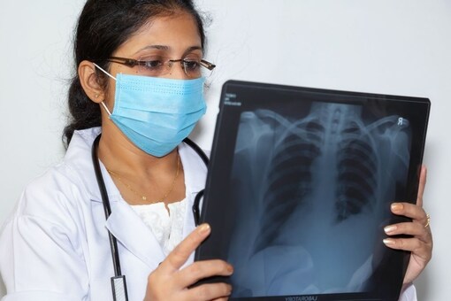 India Has Just One Radiologist for 100 Scans A Day. Here’s How It Can ...