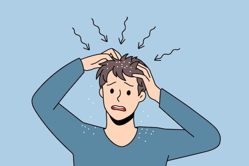 What Is Scalp Acne And How To Treat It Right - News18