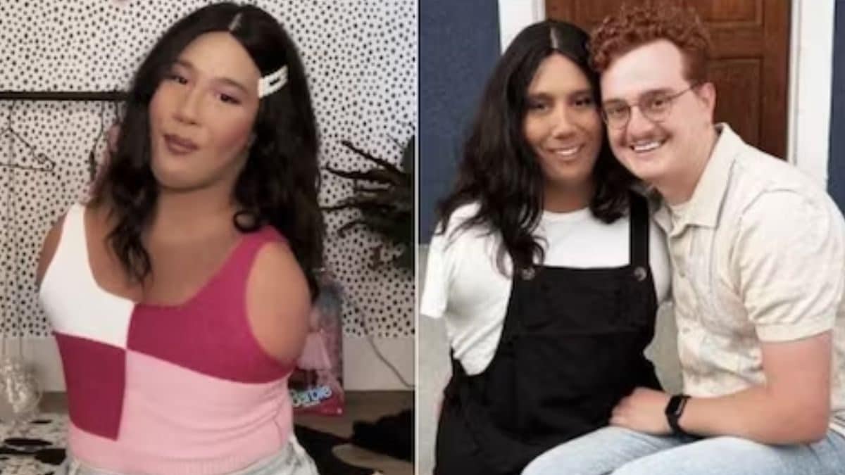 How This Transgender With No Limbs Became An Inspiration For Many ...