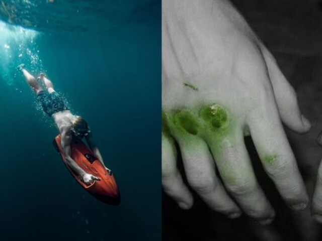 Why Human Blood Appears Green Underwater - News18