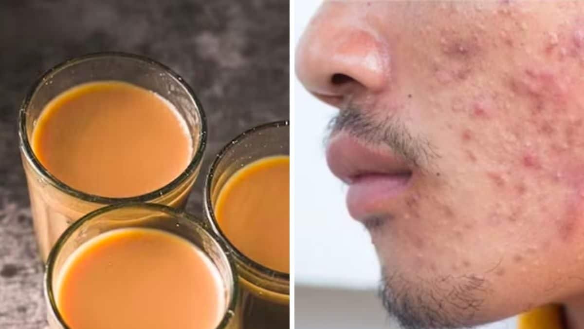 Disturbed Hormonal Balance To Allergies, 6 Side Effects Of Drinking ...