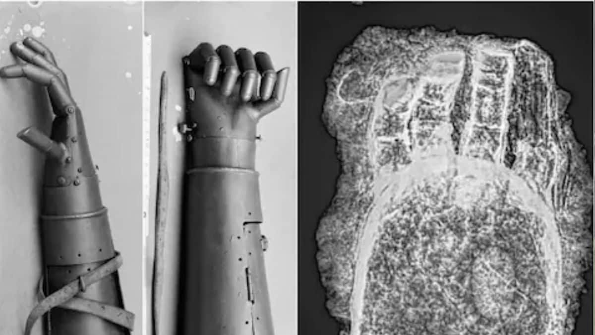 German Archaeologists Find Medieval Era Skeleton With Iron Prosthetic ...