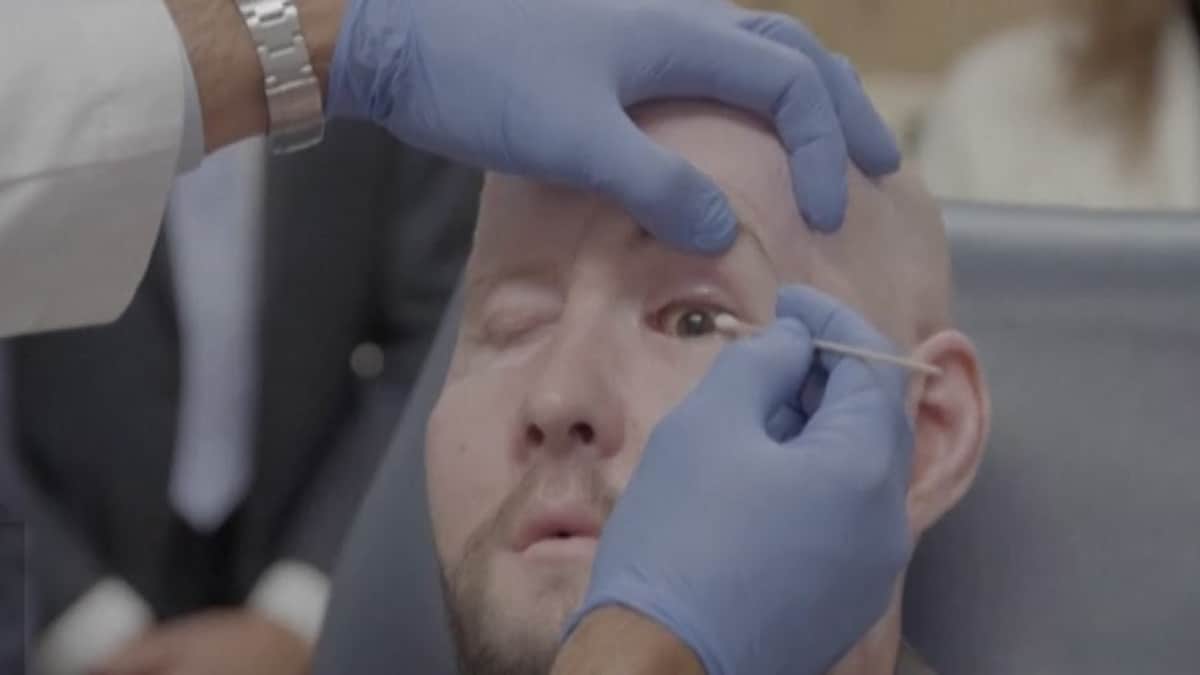 New York Surgeons Perform World's First Whole Eye Transplant | Viral ...