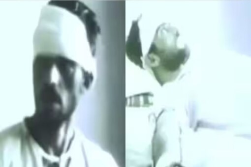 This Video From 1955 Shows The Devastating Effects of Rabies - News18