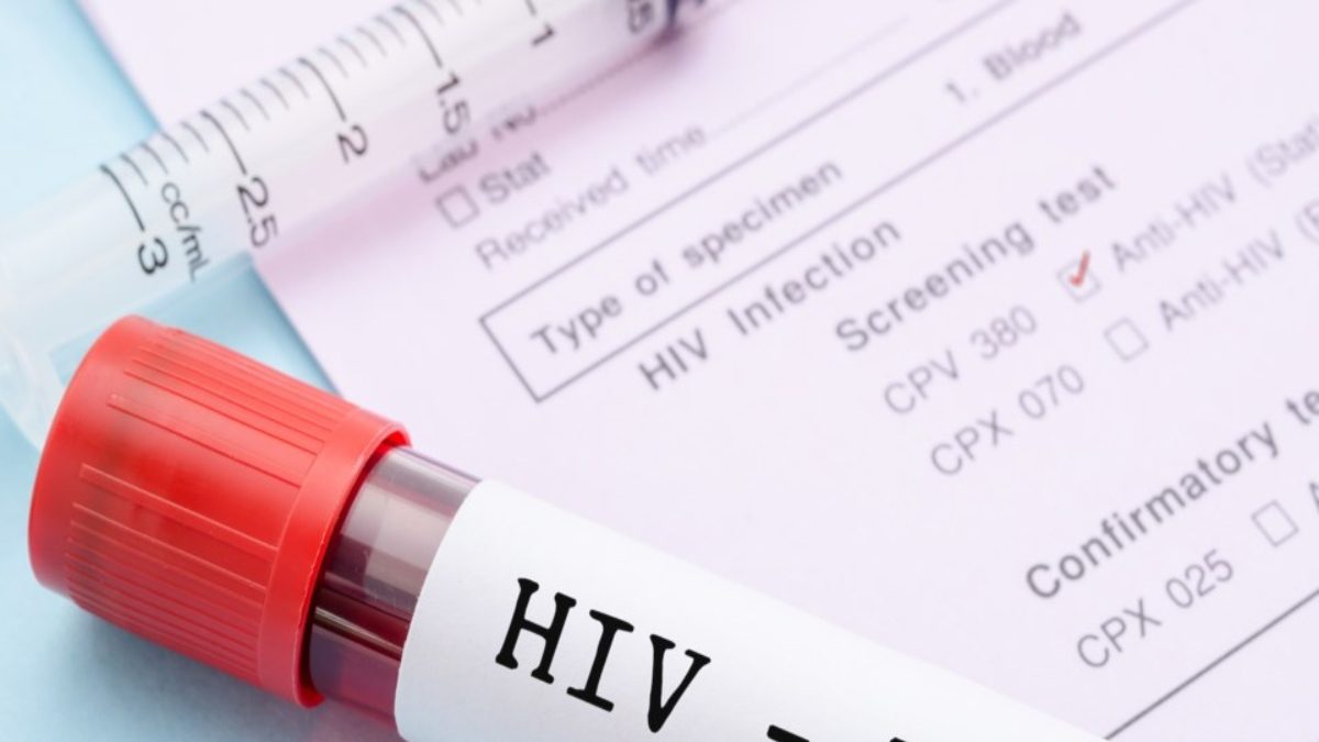 Debunking The Myth: Can HIV Be Spread Through Kissing? | Lifestyle News ...
