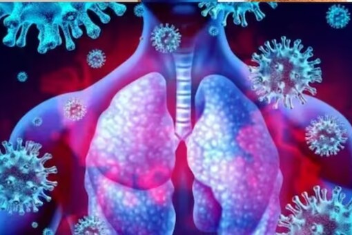 Explained: What Is White Lung Pneumonia And Why It Is So Dangerous - News18