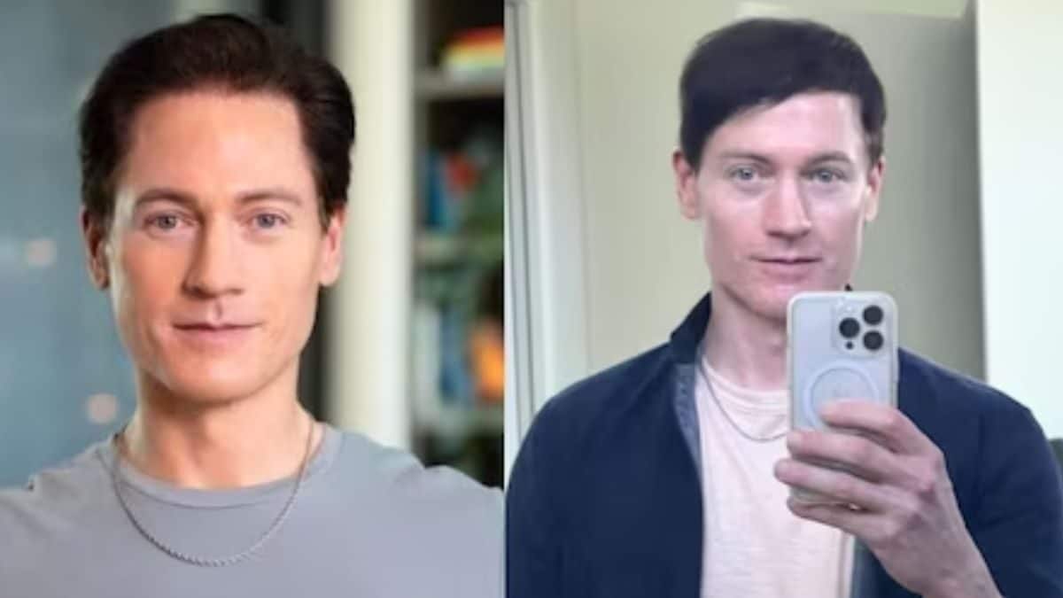 Ten Months Into De-ageing 'Project Baby Face', Tech Mogul Bryan Johnson ... Ten Months Into De-ageing 'Project Baby Face', Tech Mogul Bryan Johnson ...