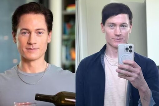 Ten Months Into De-ageing 'Project Baby Face', Tech Mogul Bryan Johnson ...