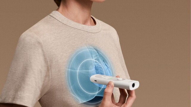CES 2024: 'BeamO' Is A New 4-in-1 Device That Gives You A Lung, Heart ...