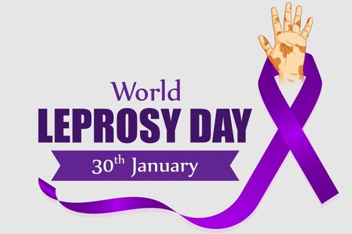 Leprosy Day 2024: History, Significance, Early Signs, Symptoms and ...