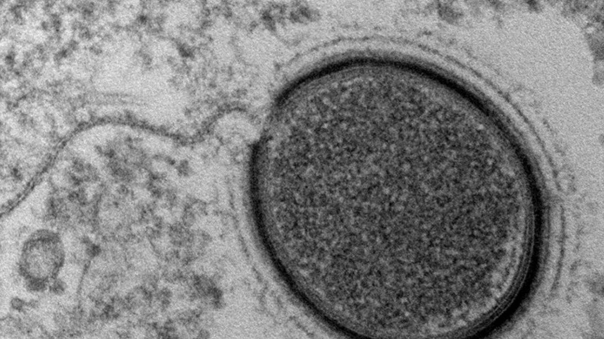 'Zombie' Viruses Frozen in Arctic Permafrost Could Be Freed as World ...