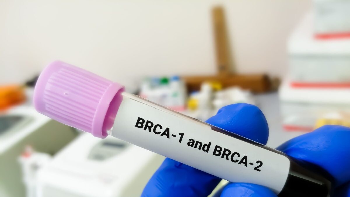 Brca Gene Testing Everything You Need To Know About It News18