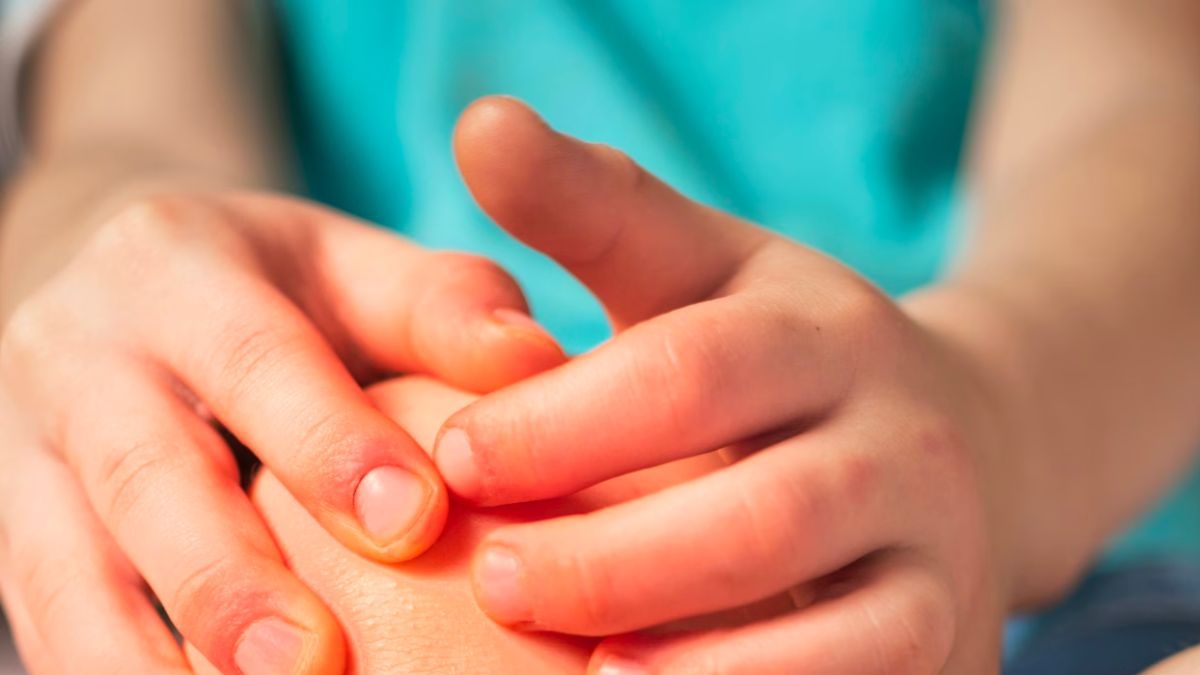 Understanding The Onset of Arthritis In Children | Lifestyle News - News18