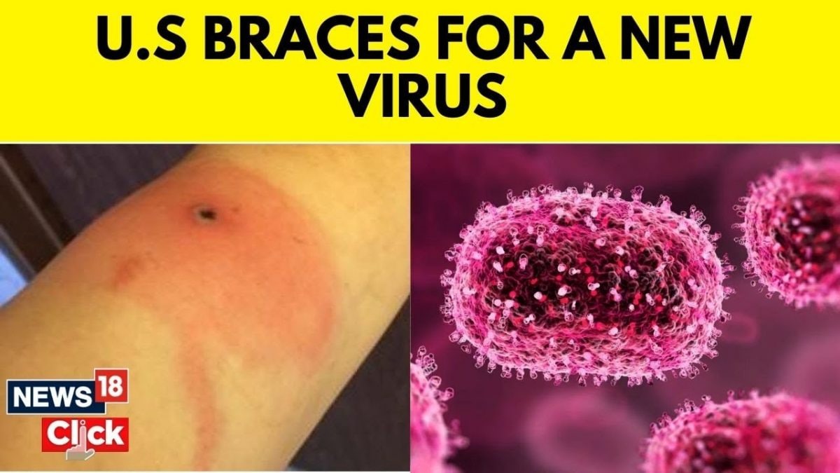Alaskapox Virus | What Is Alaskapox? The Newly Found Viral Disease That ...