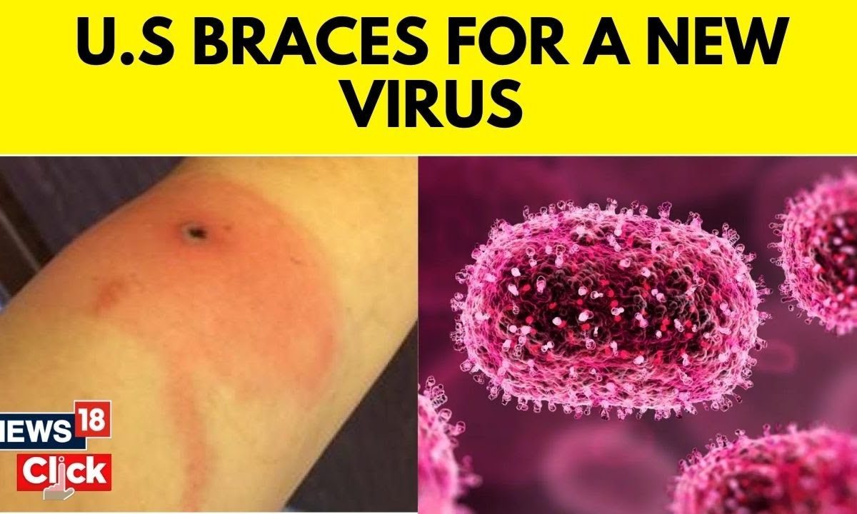 Alaskapox Virus | What Is Alaskapox? The Newly Found Viral Disease That ...
