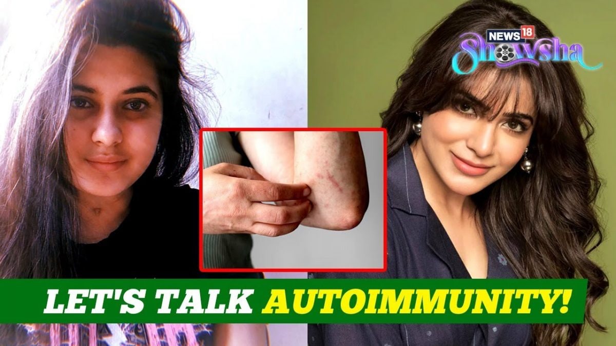 What Is An Autoimmune Disease, Which Samantha Ruth Prabhu Suffers From & That Claimed Suhani's ...