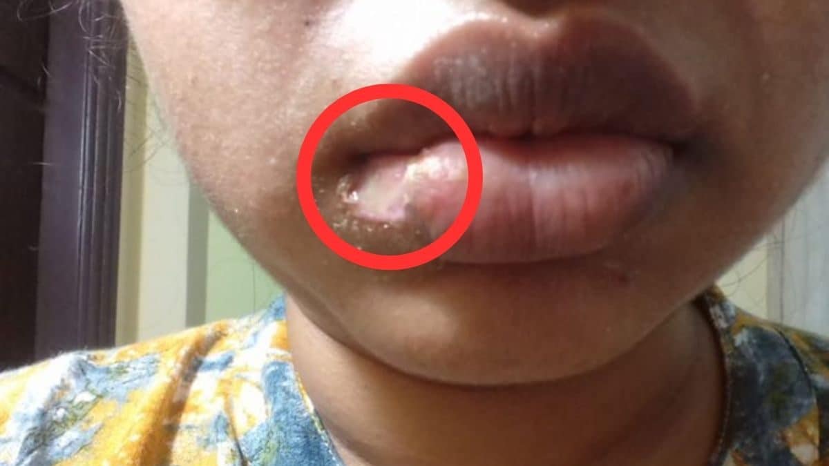 Hyderabad Dental Hospital Under Fire Again Following Viral Post About ...