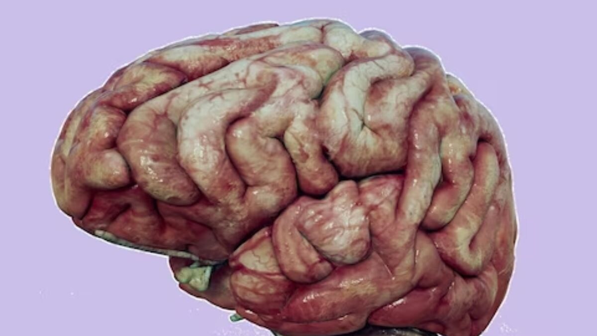 Scientists Develop 3D-Printed Brain Tissue, Opens New Dimension For ...
