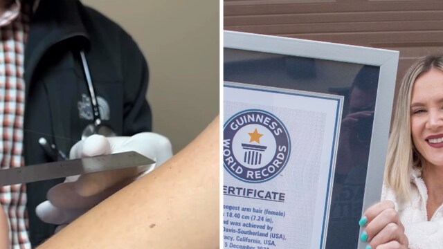 Woman With Longest Arm Hair, 18 Cm, Now Holds A World Record | Viral ...