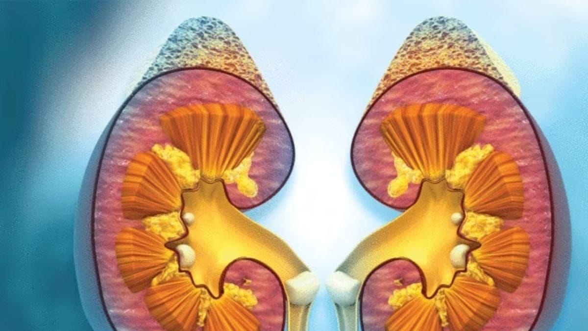 Kidney Transplant 101: What You Need to Know | Lifestyle News - News18