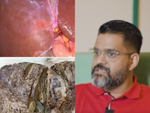 Doctor Calls Out Instagram's Policy On Alcohol Content: ‘IG Is Funny ...