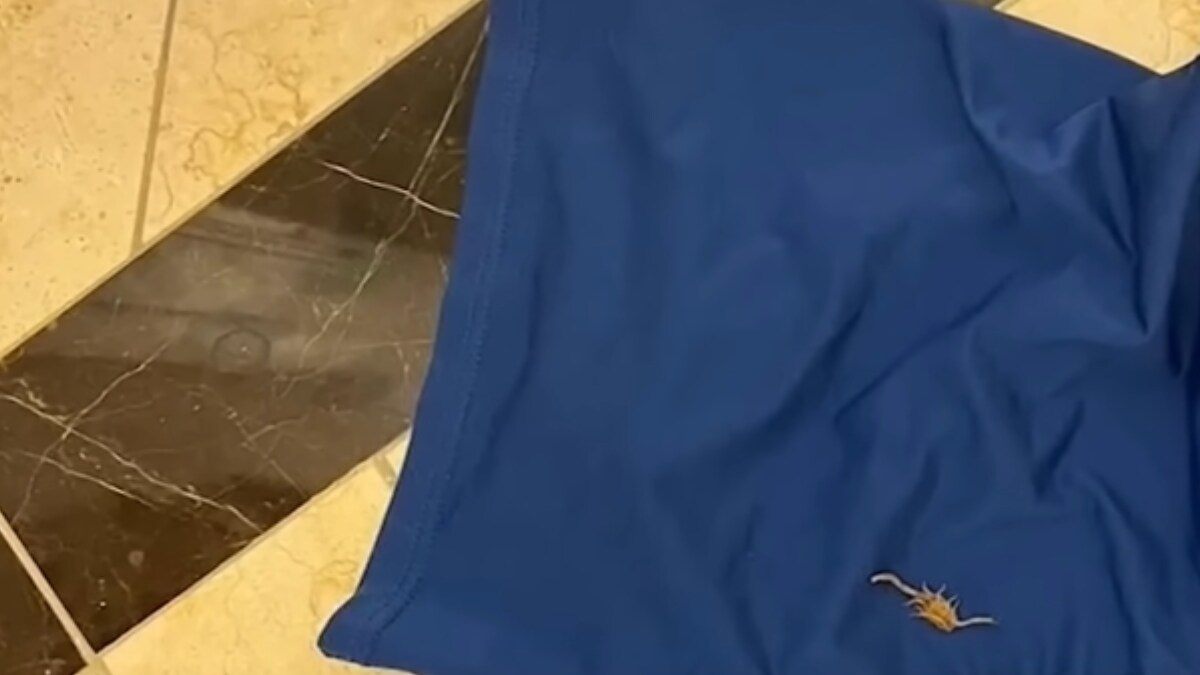 Las Vegas Hotel In Legal Trouble As Man Claims Scorpion Stung His ...