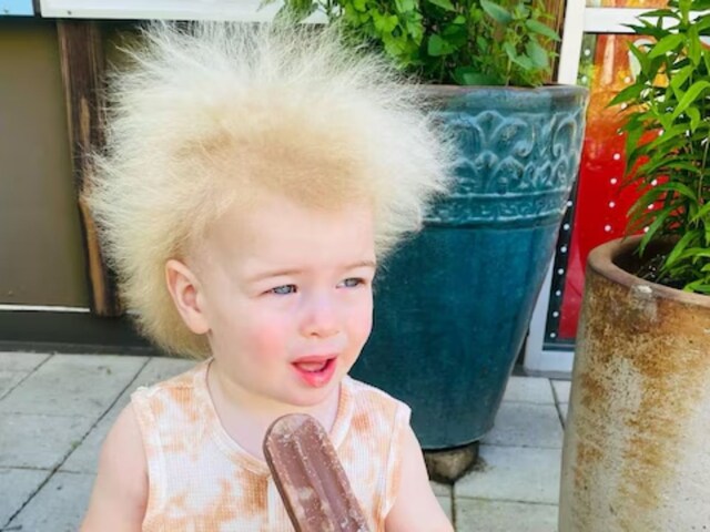 UK Girl Suffers From Rare Condition That Makes Her Hair Uncombable - News18
