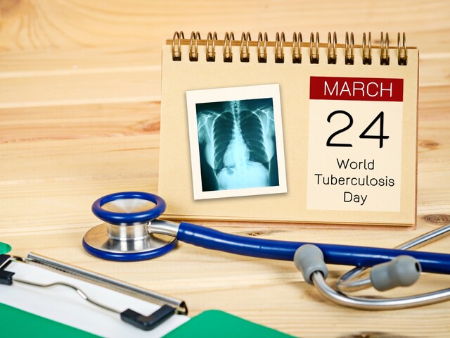 World Tuberculosis Day 2024: Theme, History, TB Causes, Symptoms, and ...