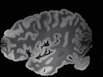 World's Most Powerful MRI Scans First Images Of Human Brain - News18