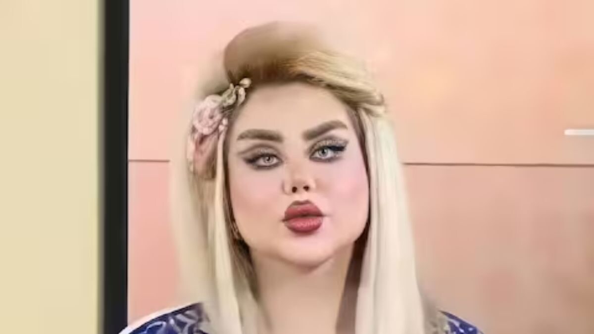 Iraqi Woman Undergoes 43 Surgeries; Here's Why - News18