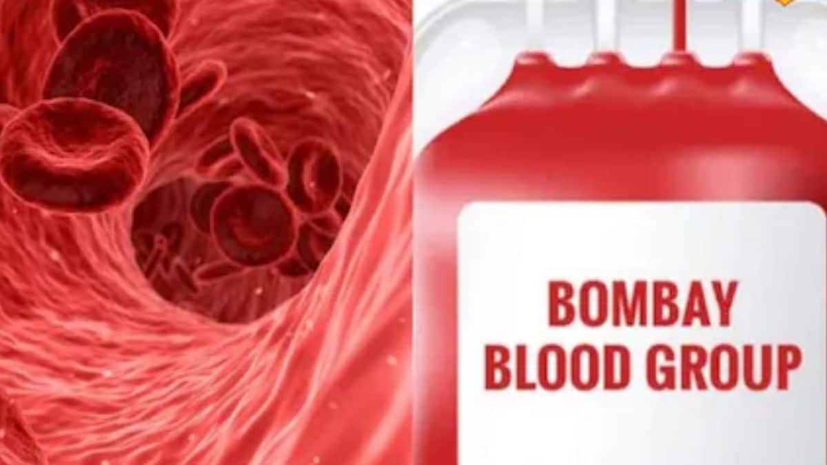 This Blood Group, With Unique Characteristics, Is Considered The Rarest ...