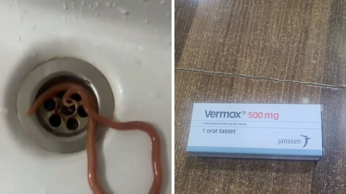 Man, Suffering From Abdominal Pain, Vomits Live Worm After Complaining ...