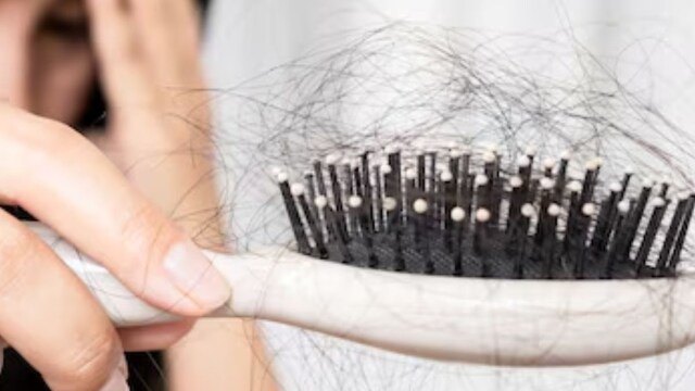 Excessive Hair Fall During Monsoon? Here’s How To Prevent It ...