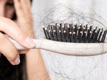 Excessive Hair Fall During Monsoon? Here’s How To Prevent It - News18