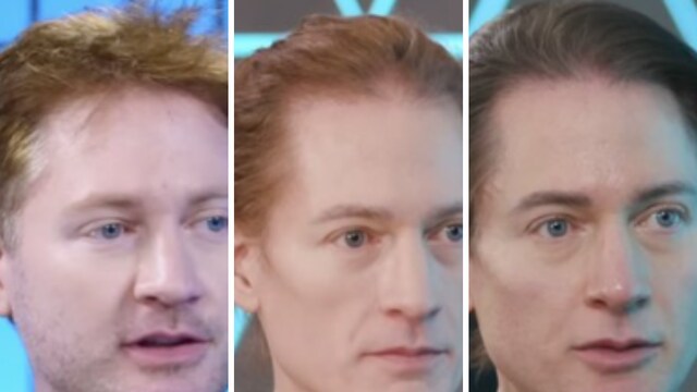 Tech Billionaire Bryan Johnson's Anti-ageing Transformation Pictures ...