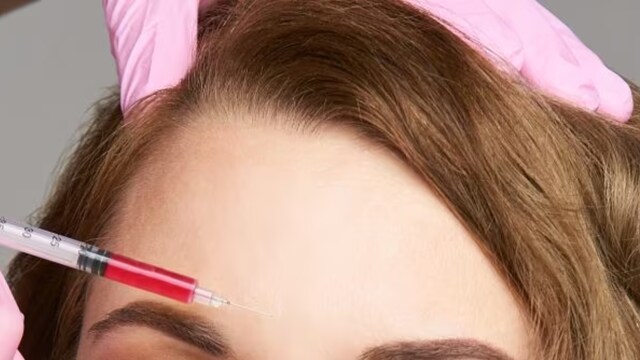 How Vampire Facial Left 3 Women Infected with HIV, How It Has Become A ...