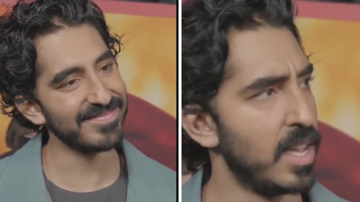 This Is What Dev Patel Has to Say About Representation Of Transgender ...
