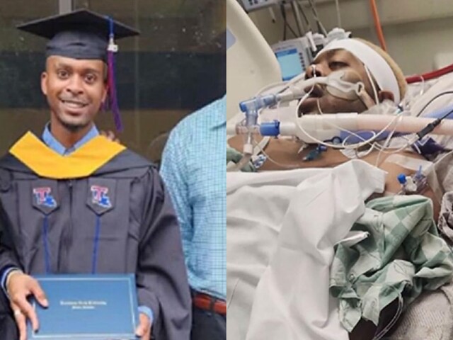 Aspiring Doctor Left Brain Dead After Being Pushed Into Lake by ...